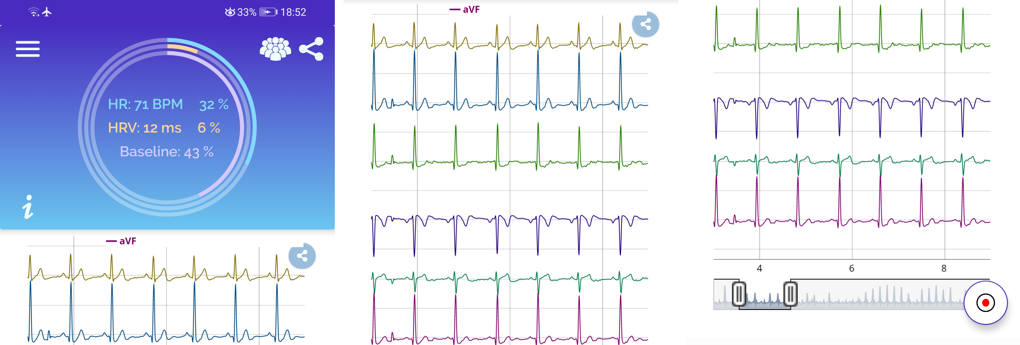 Mobile ECG Sensing Extender Order Page